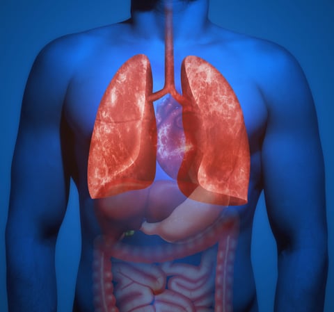 The Confusing Connection Between Drinking and COPD