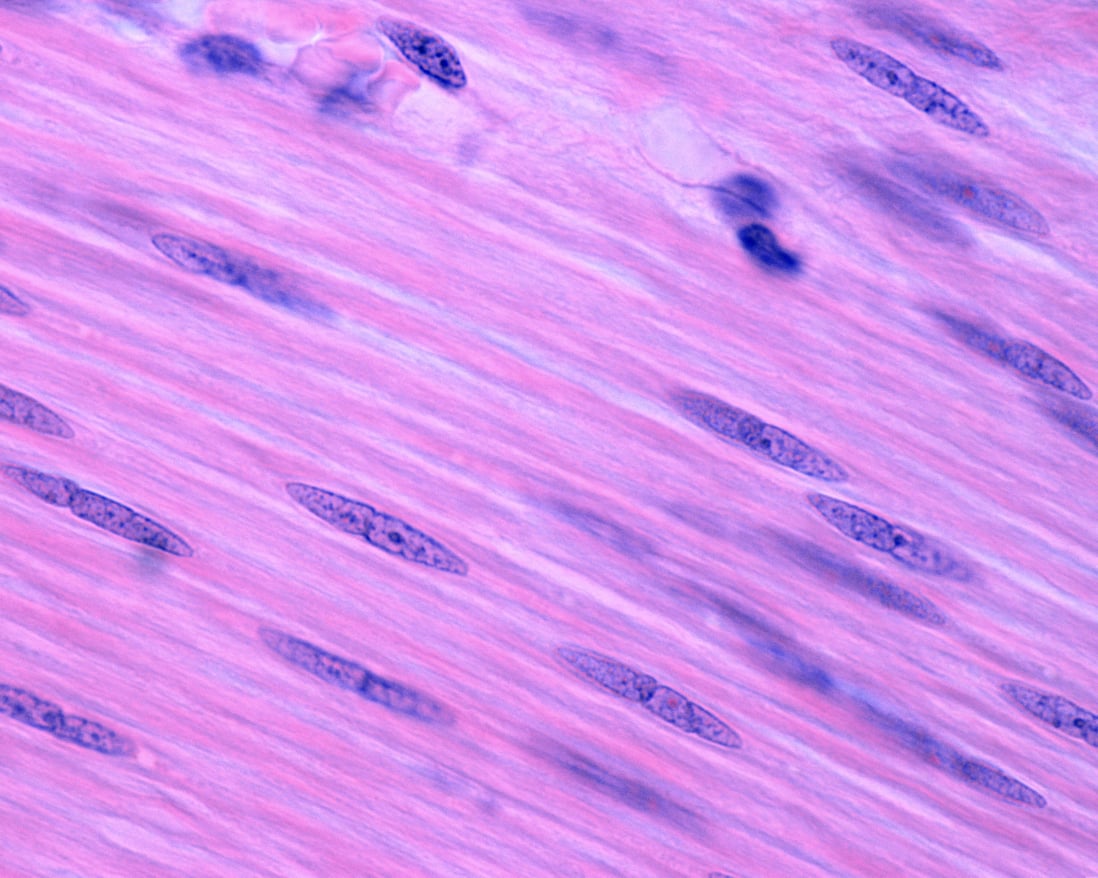 What Are Bronchospasms in COPD and How Are They Treated?
