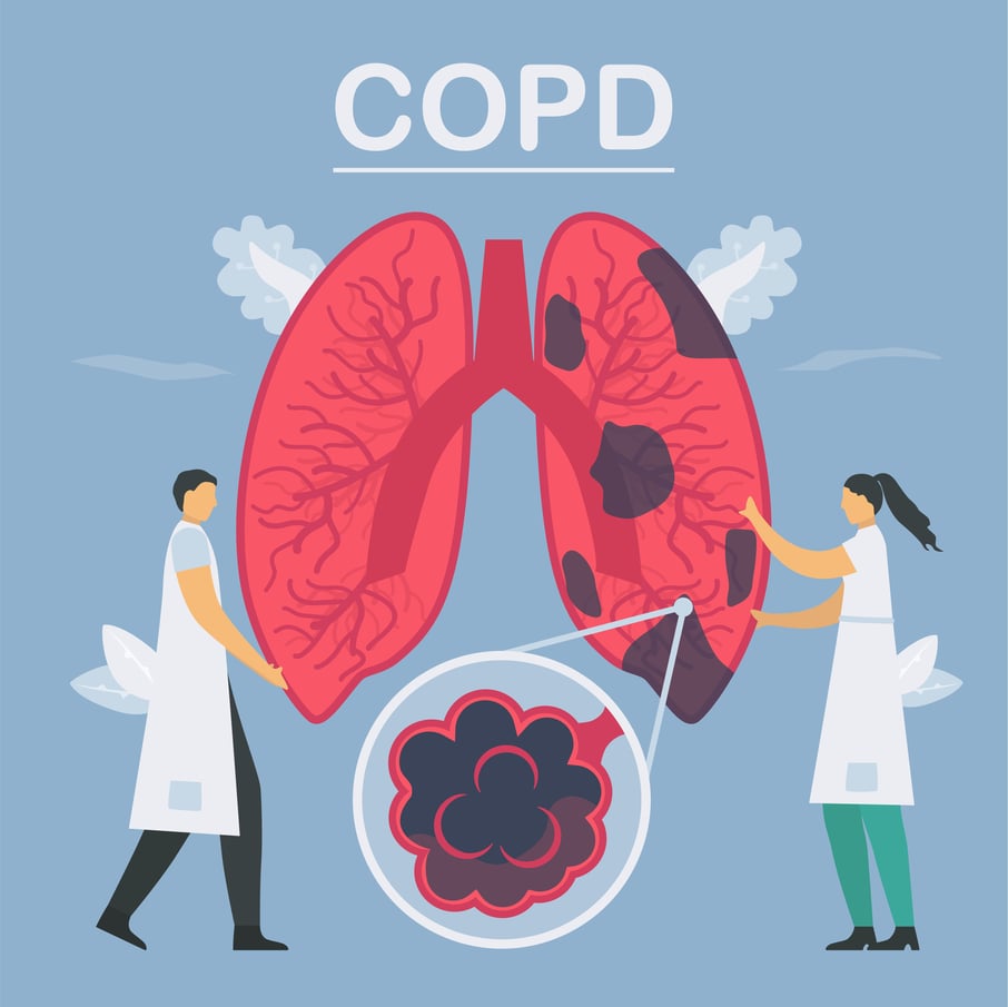 The Basics Behind COPD and the Secrets You Need to Know – LPT Medical